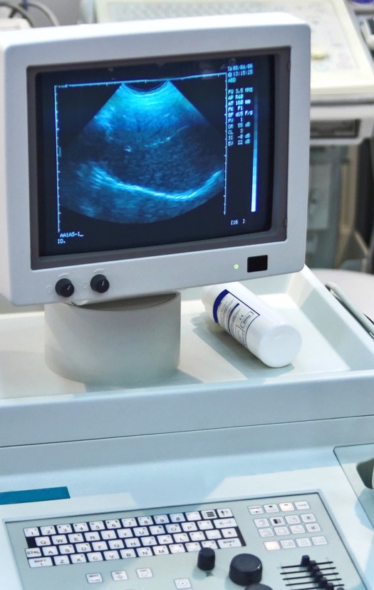 Radiology/Ultra-Sound – RSBCIHI